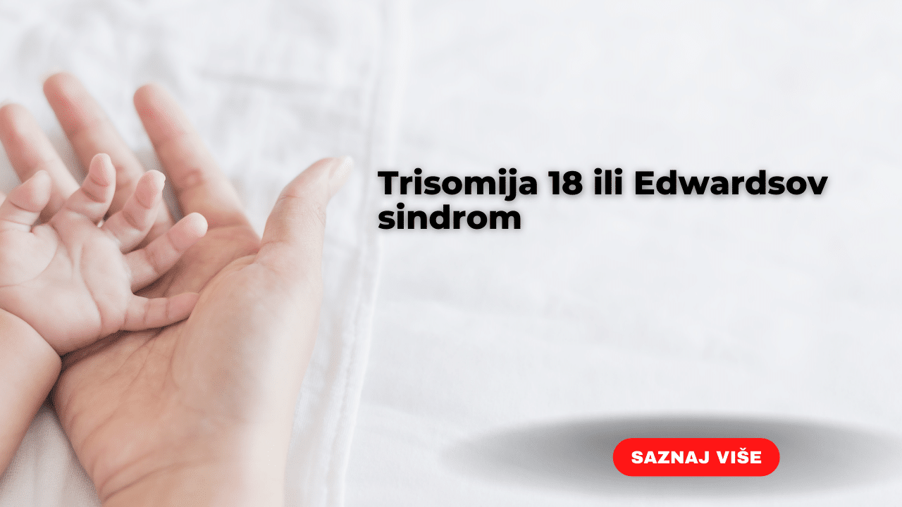 Trisomija 18 ili Edwardsov sindrom: Uzrok i simptomi